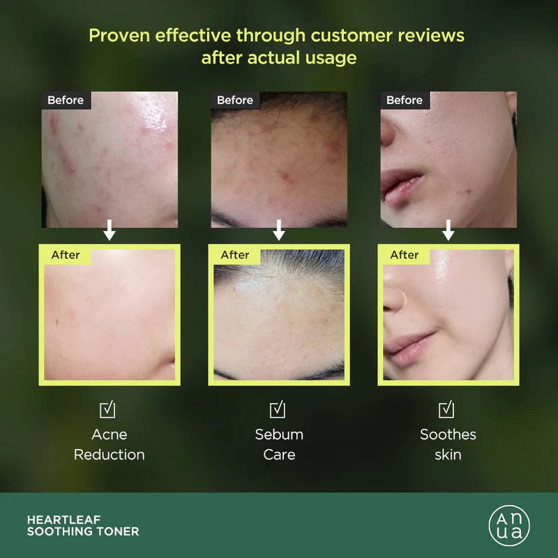 ANUA HEARTLEAF 77% SOOTHING TONER 250ML 아누아 어성초 77% 진정 토너 250ML ...